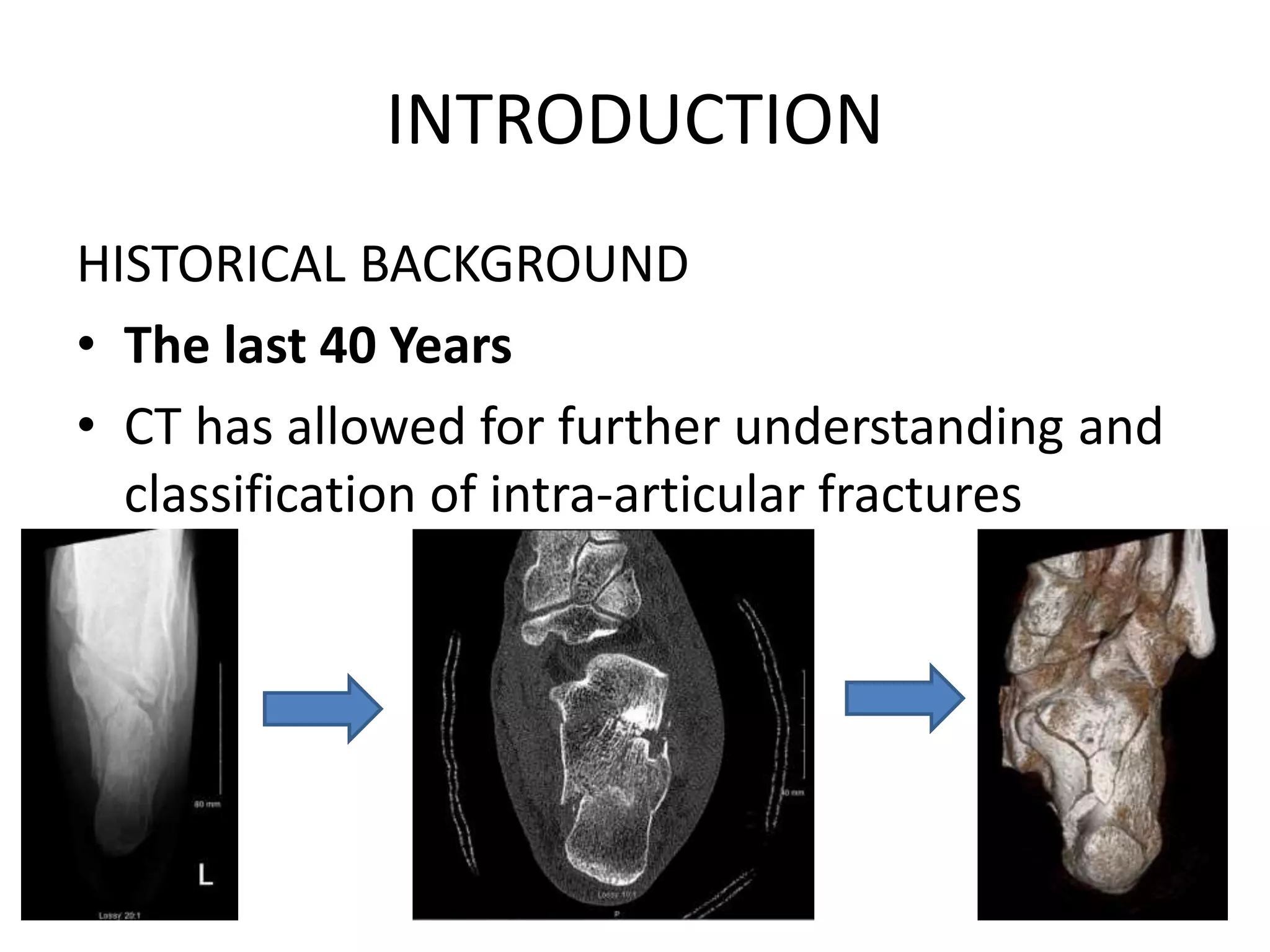 FRACTURE- Aetiology, Classification and Complications.pptx