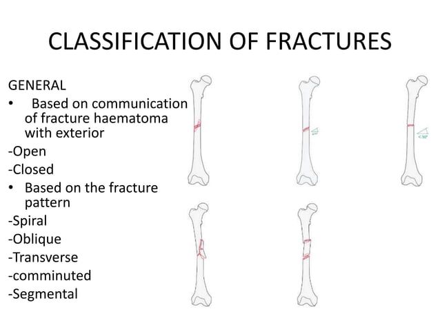 FRACTURE- Aetiology, Classification and Complications.pptx