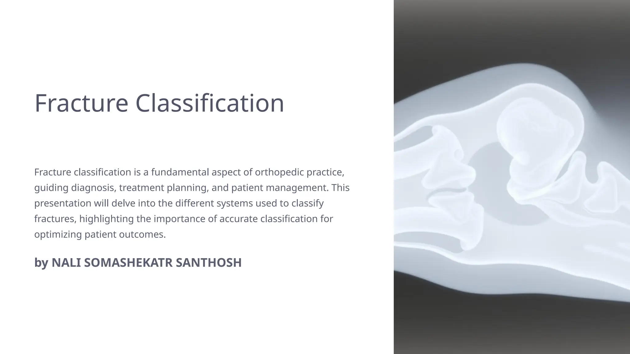 Fracture-Classification and types and differentiation | PPTX
