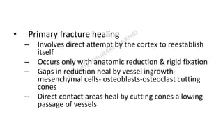 Fracture Healing | PPT