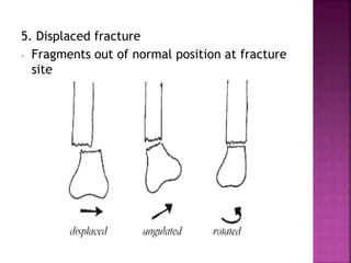 fracture-ppt.pptx