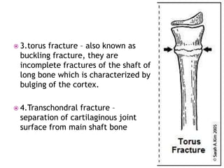 fracture-ppt.pptx