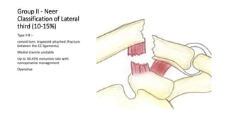 Fracture and dislocation of the shoulder girdle | PPTX