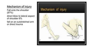 Fracture and dislocation of the shoulder girdle | PPTX