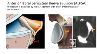 Fracture and dislocation of the shoulder girdle | PPTX