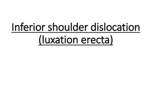 Fracture and dislocation of the shoulder girdle | PPTX