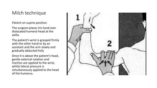 Fracture and dislocation of the shoulder girdle | PPT