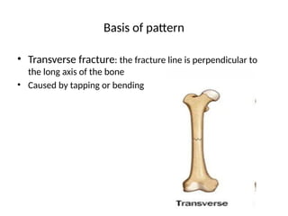 FRACTURE AND ITS CLASSIFICATIONS.slideshare | PPTX
