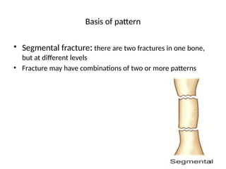 FRACTURE AND ITS CLASSIFICATIONS.slideshare | PPTX