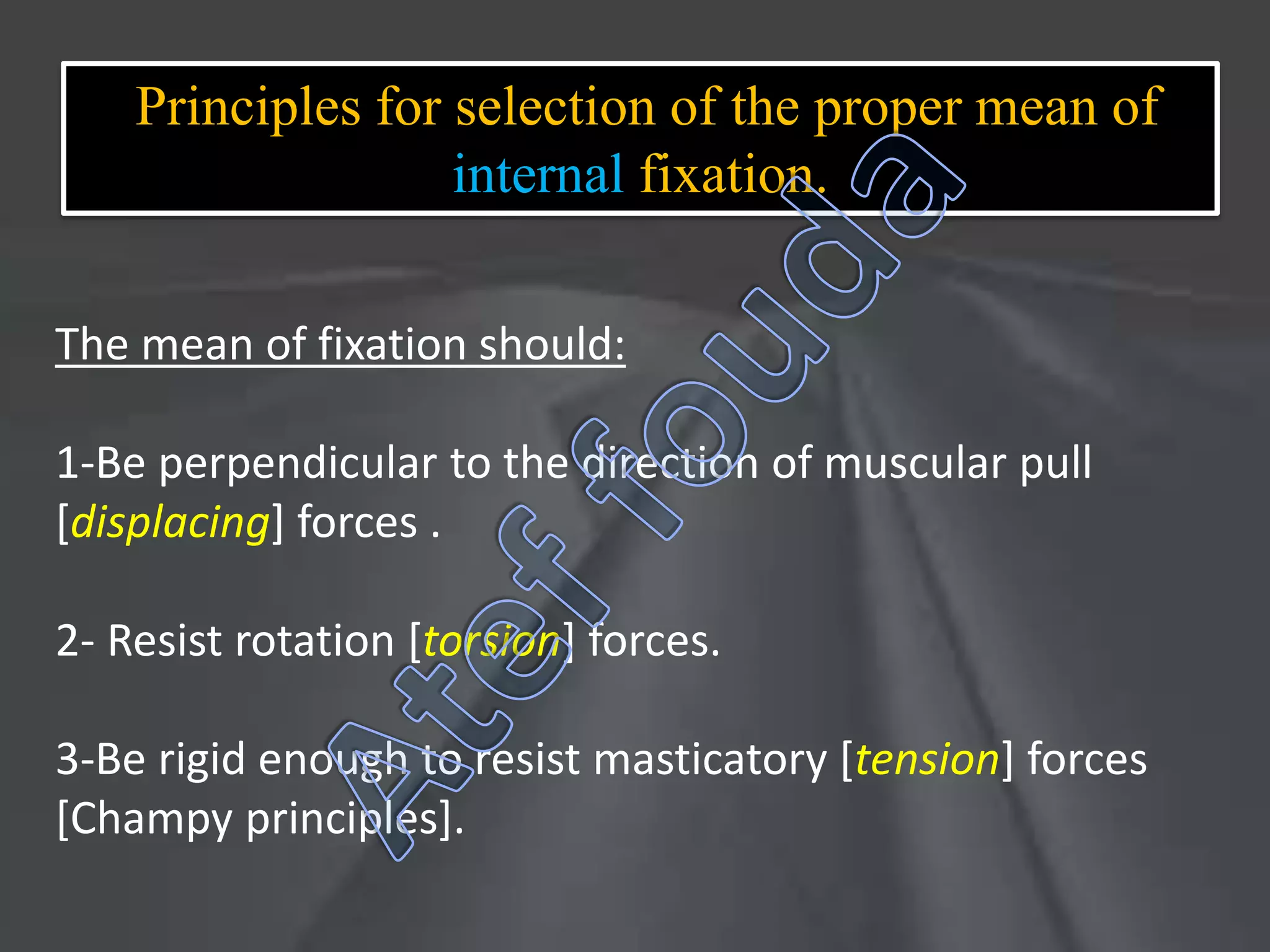 Fracture mandibular angle | PPSX