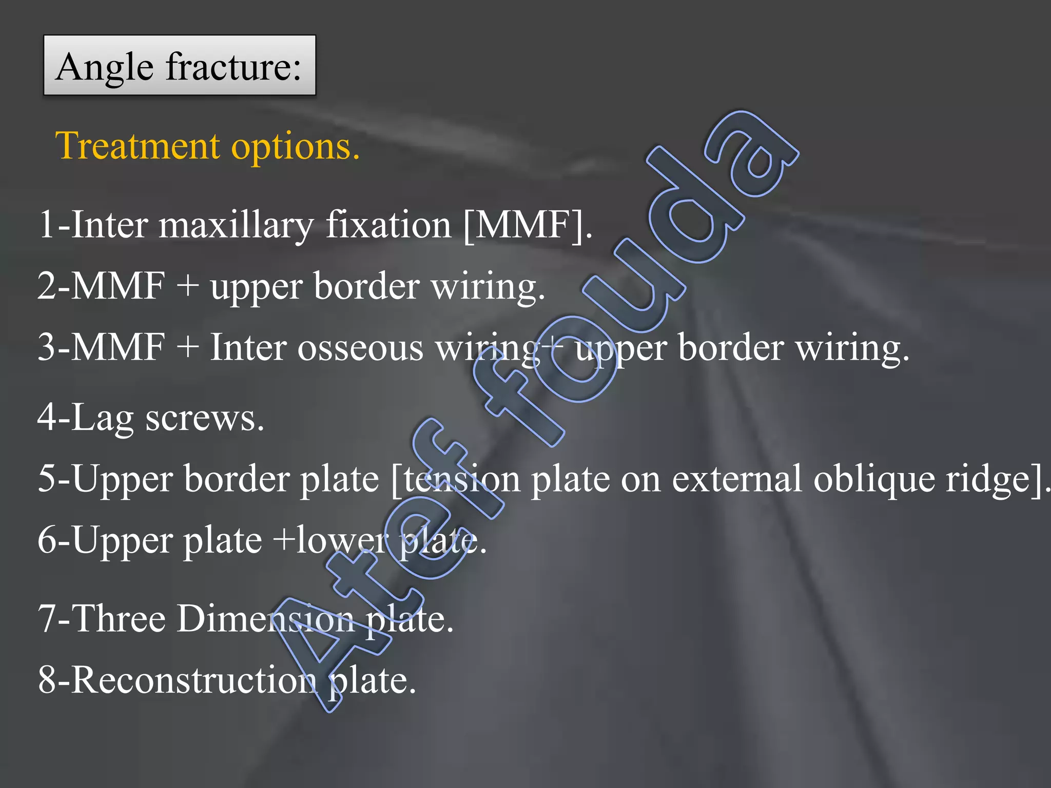 Fracture mandibular angle | PPSX