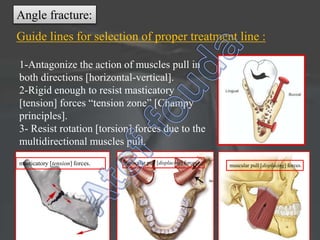 Fracture mandibular angle | PPSX