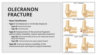 FRACTURE ANTEBRACHII DR.XIN v210520.1300.pptx