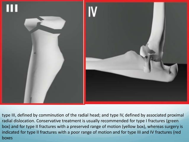 Fracture around elbow.pptx