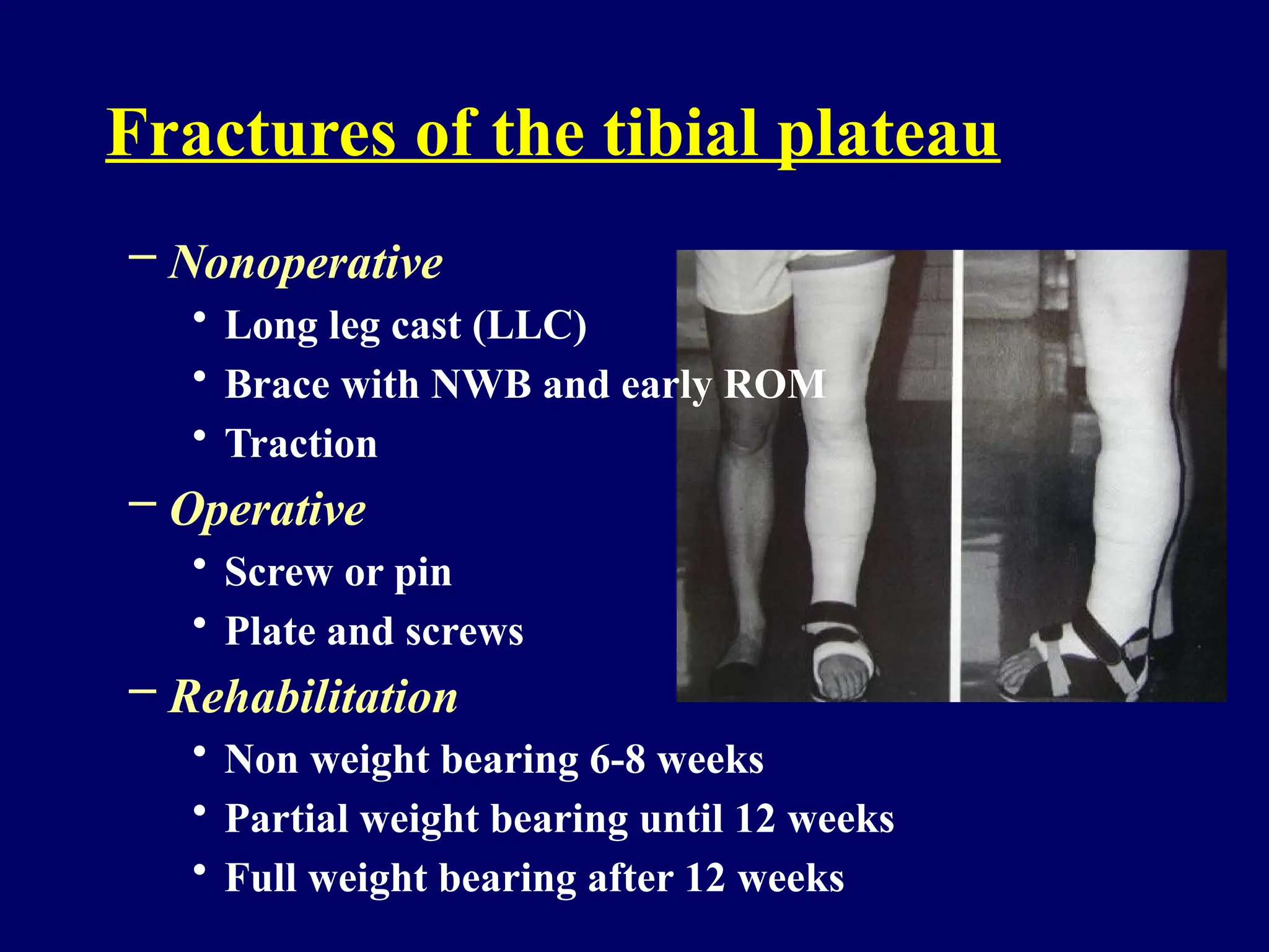 Fracture Around the Knee management.pptx