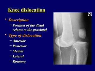 Fracture Around the Knee management.pptx
