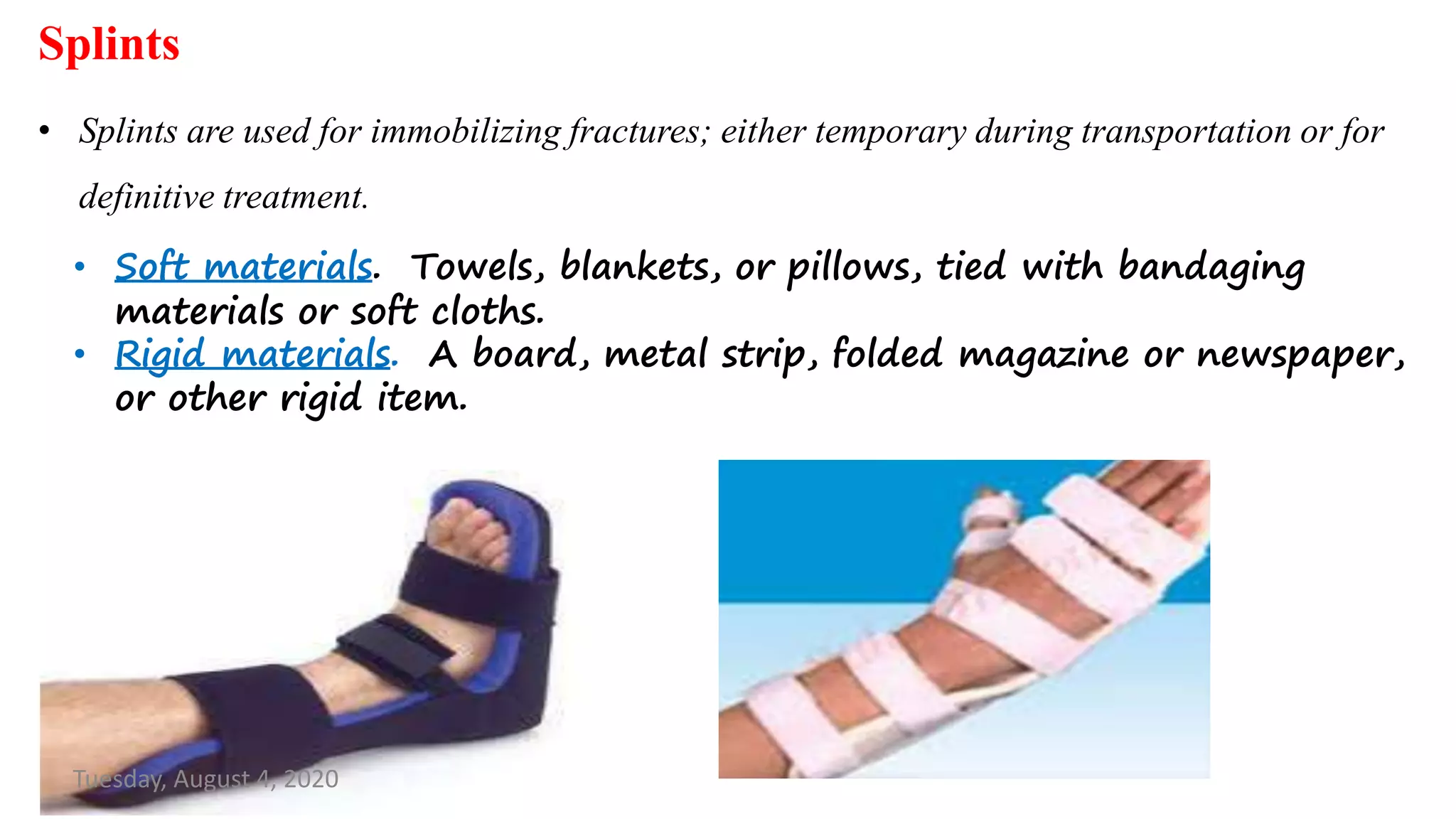 Fracture (Ayoub) | PPTX