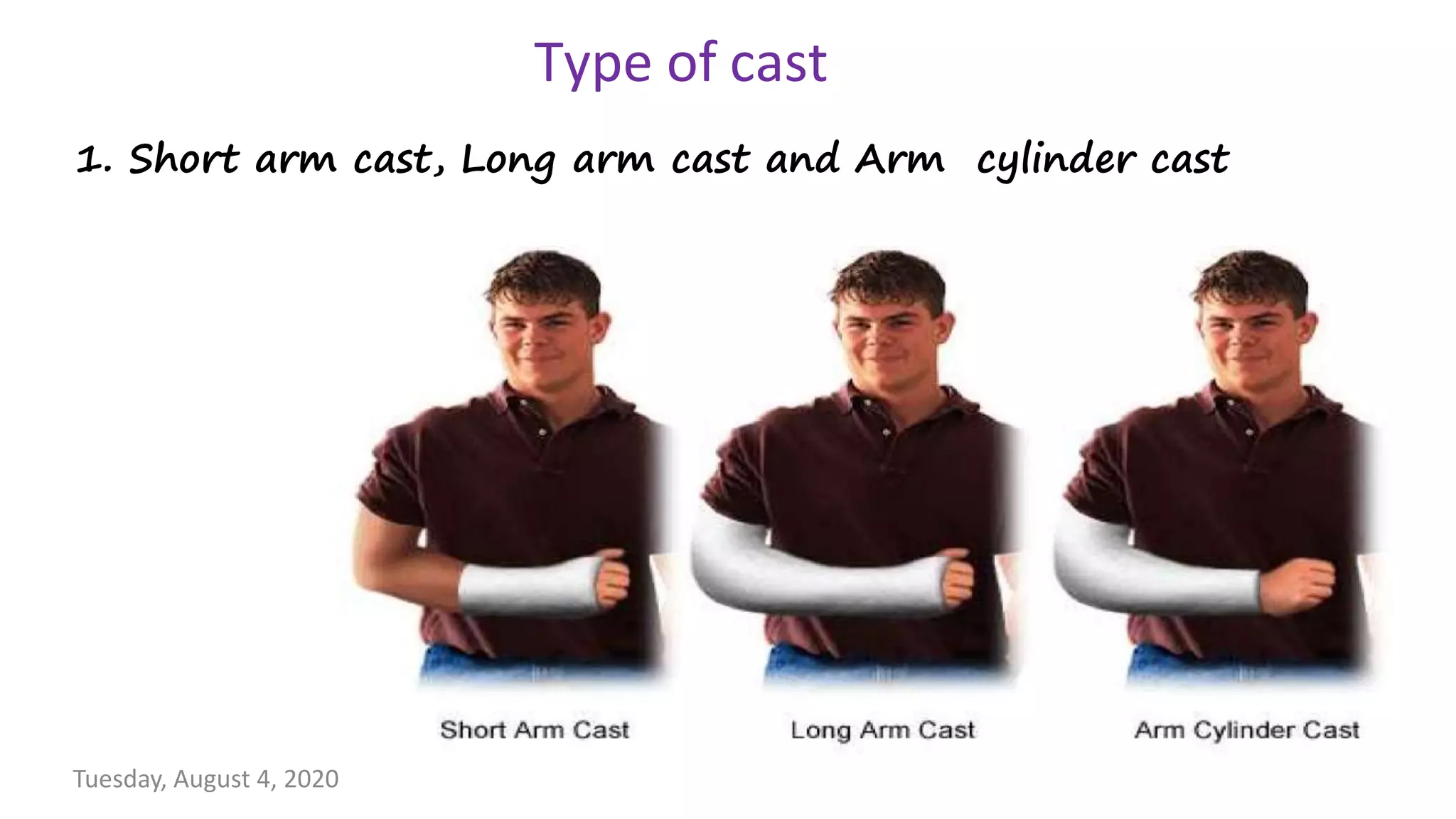 Fracture (Ayoub) | PPTX
