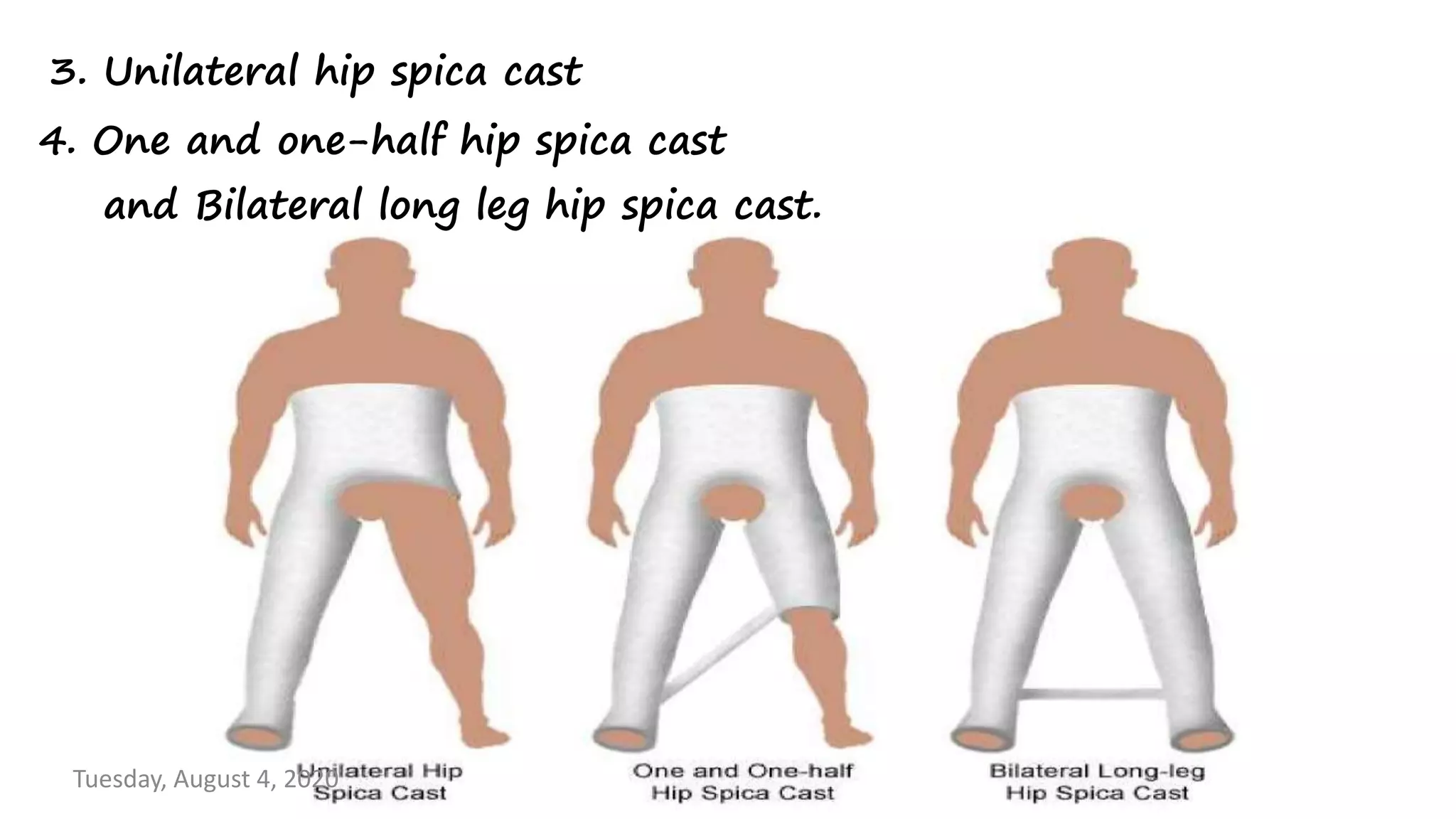 Fracture (Ayoub) | PPTX