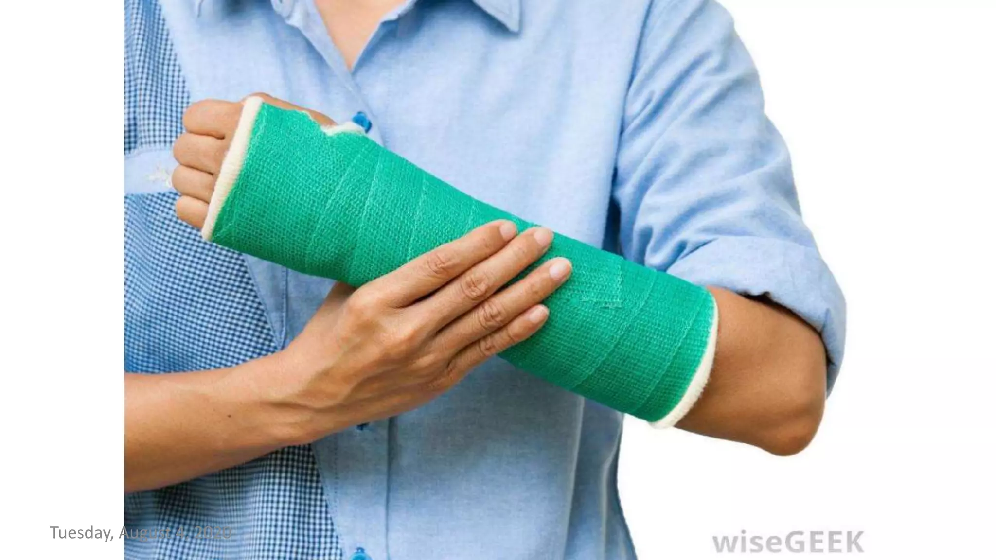 Fracture (Ayoub) | PPTX