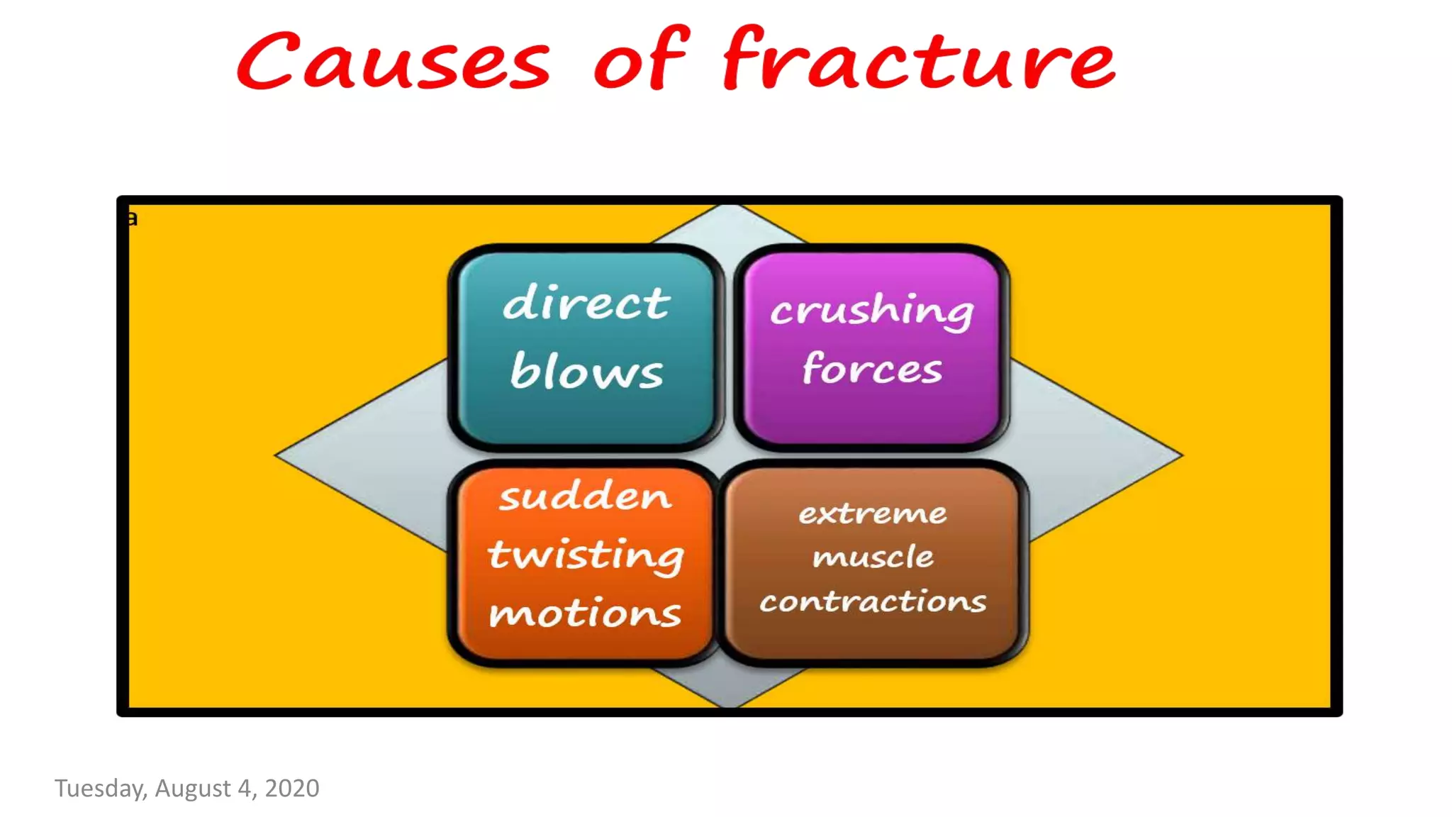 Fracture (Ayoub) | PPTX