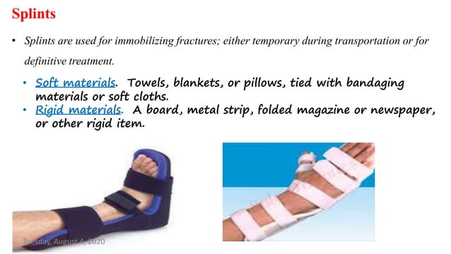 Fracture (Ayoub) | PPTX