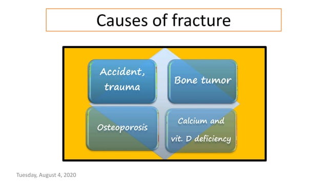 Fracture (Ayoub) | PPTX