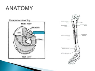 Fracture both bones leg class ug | PPTX