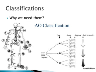 Fracture both bones leg class ug | PPTX