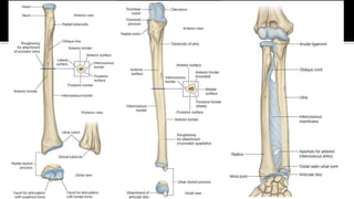 Fracture both forearm team v | PPTX