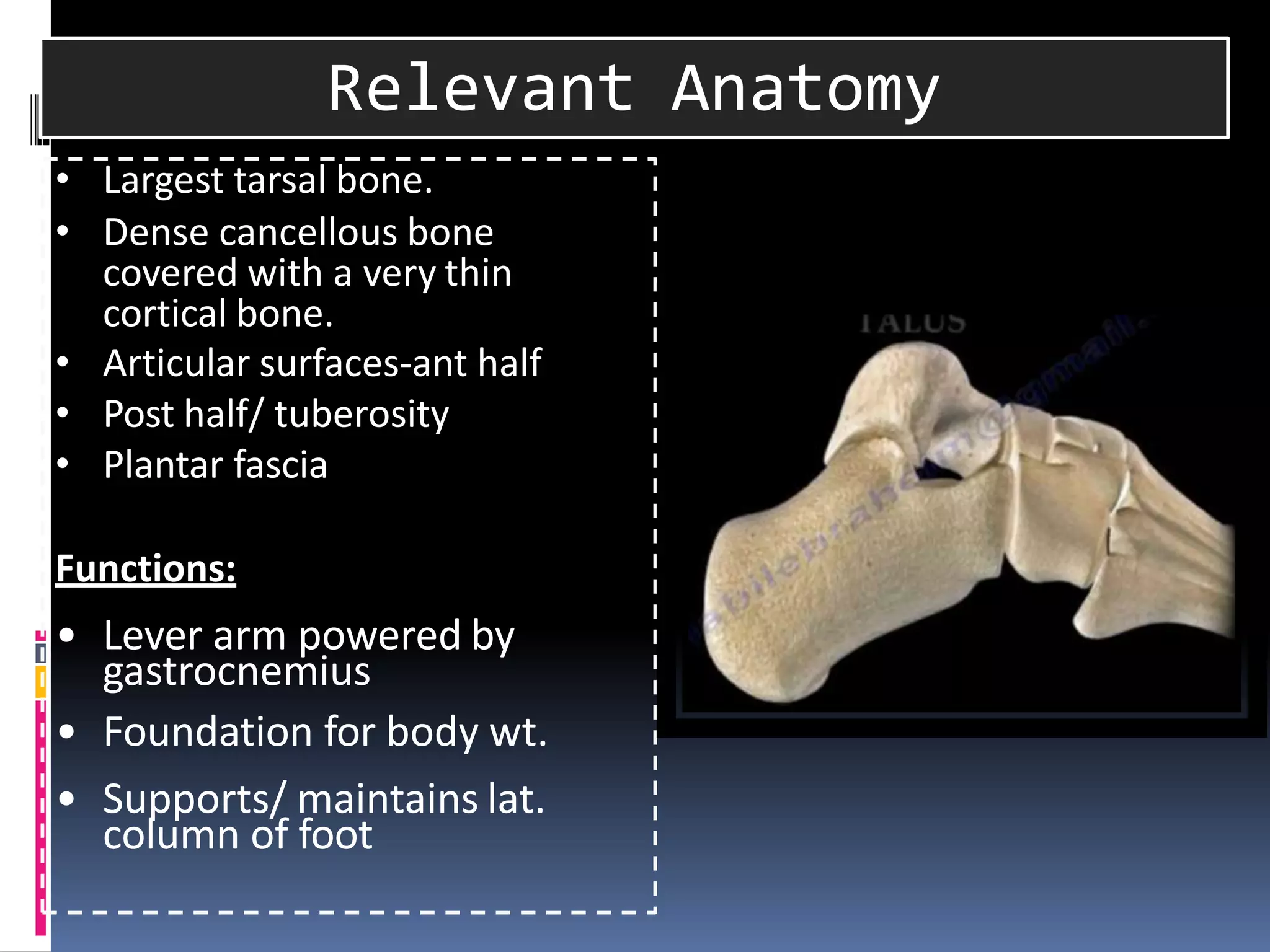 Fracture calcaneum and talus by dr ashutosh | PPTX
