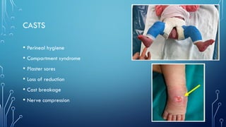 Fracture care with safety- A guide to nursing care | PPTX