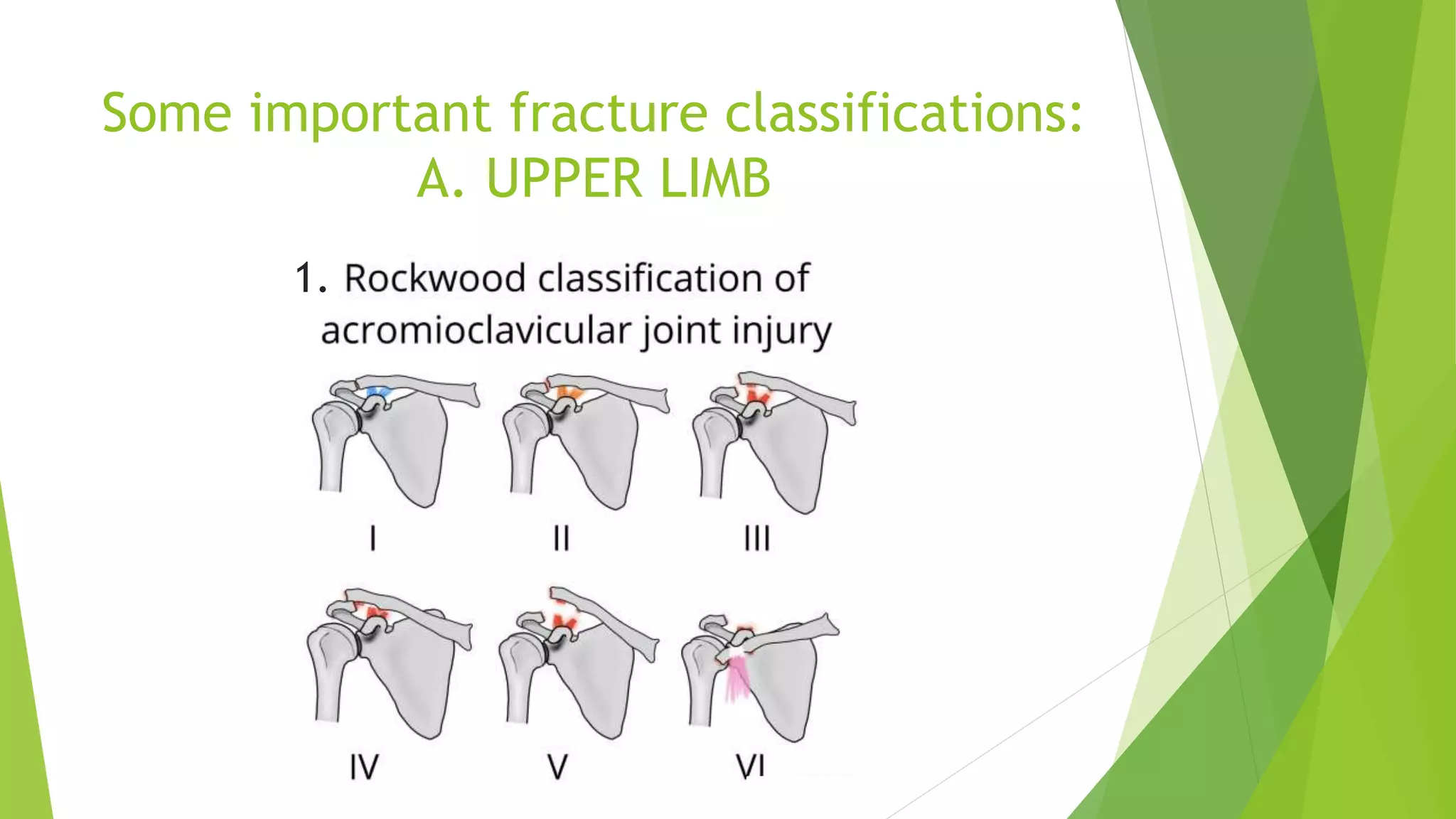Fracture classification | PPTX