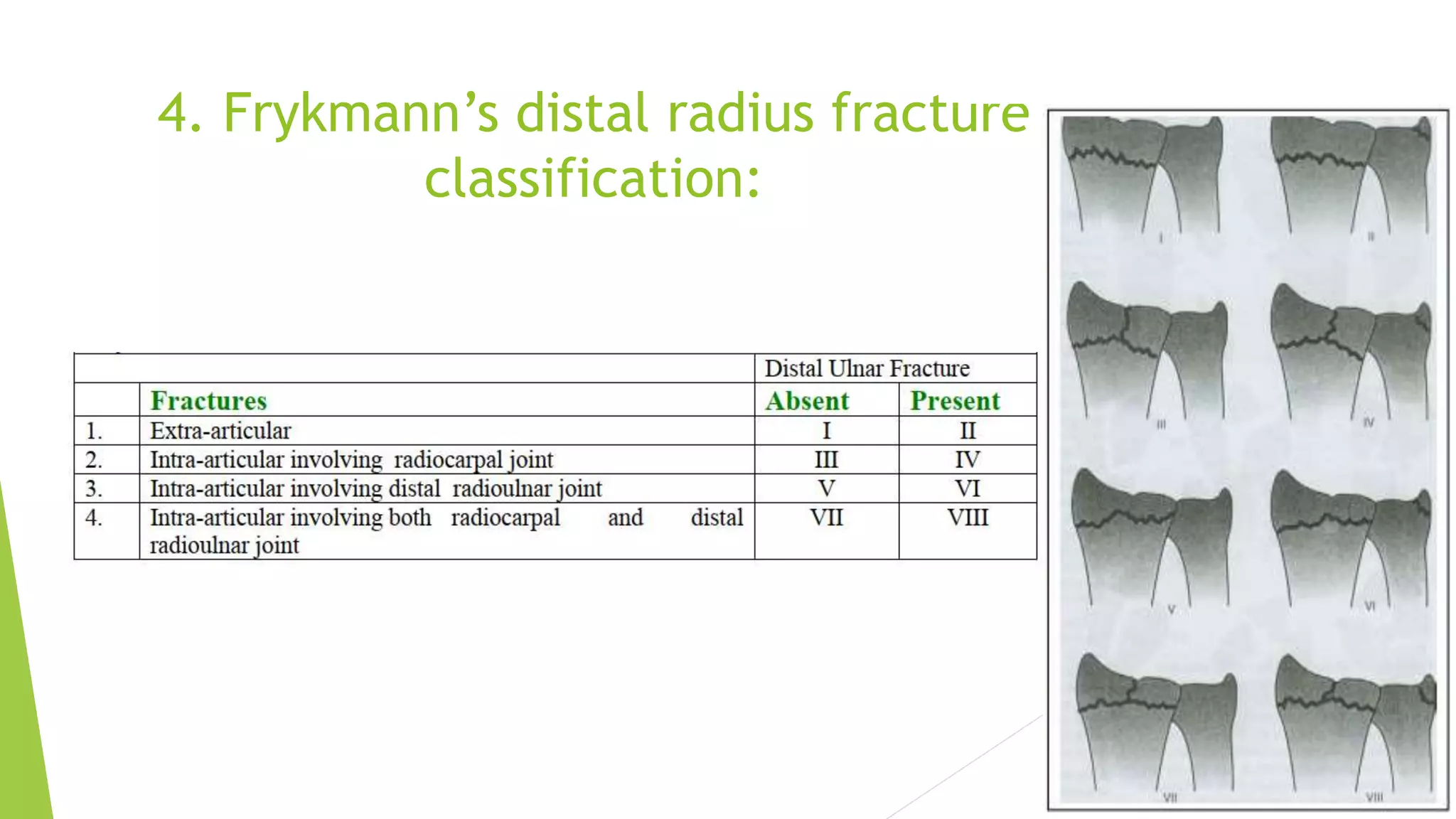 Fracture classification | PPTX
