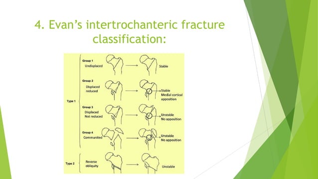 Fracture classification | PPT