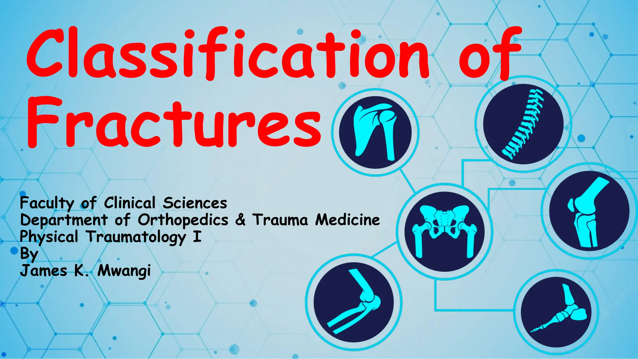 Fracture Classification .pptx notes for orth | PPTX