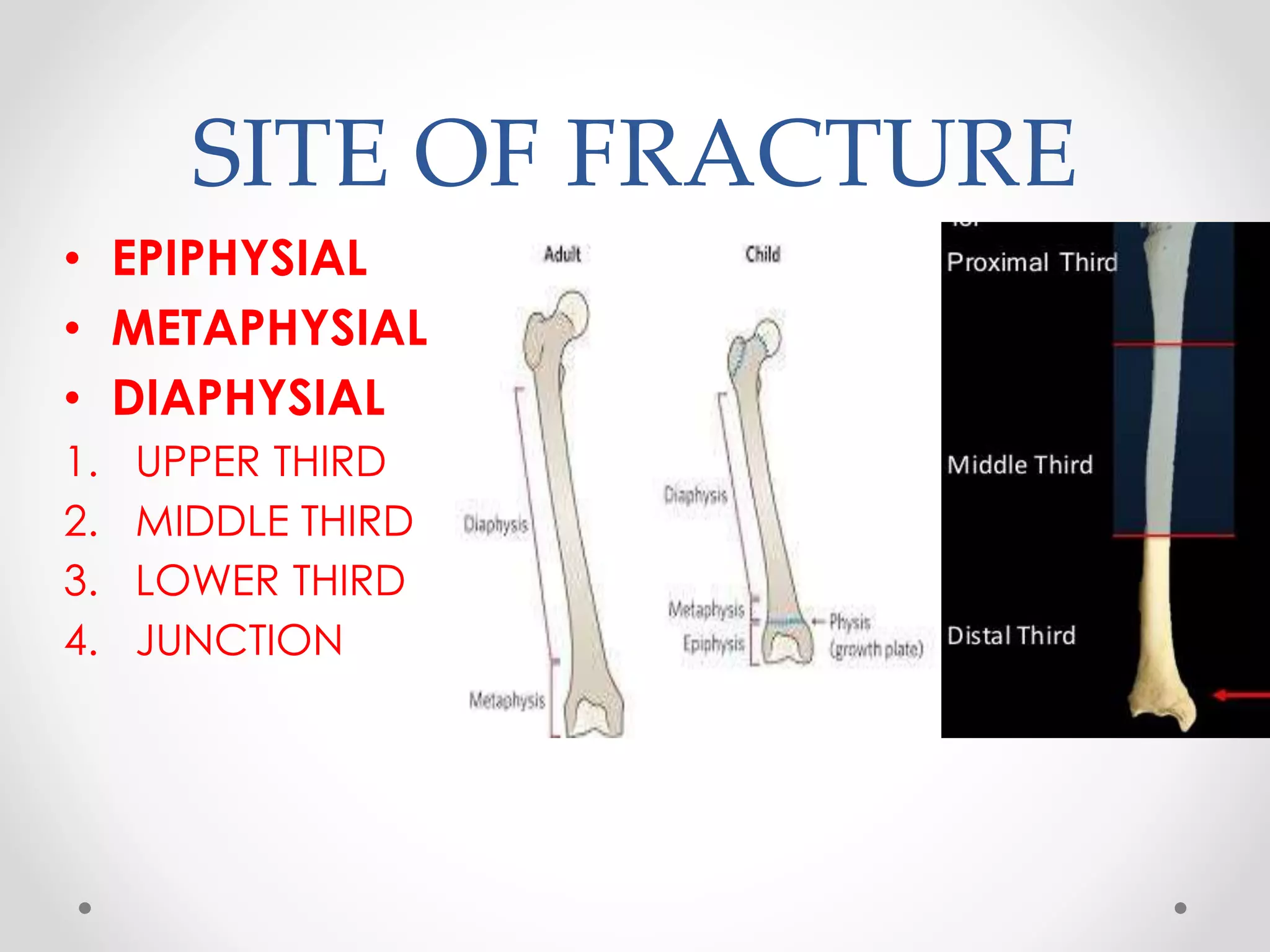 Fracture & classification | PPTX