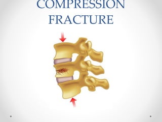 Fracture & classification | PPTX