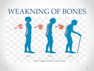 Fracture & classification | PPTX