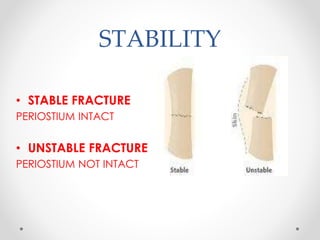 Fracture & classification | PPTX
