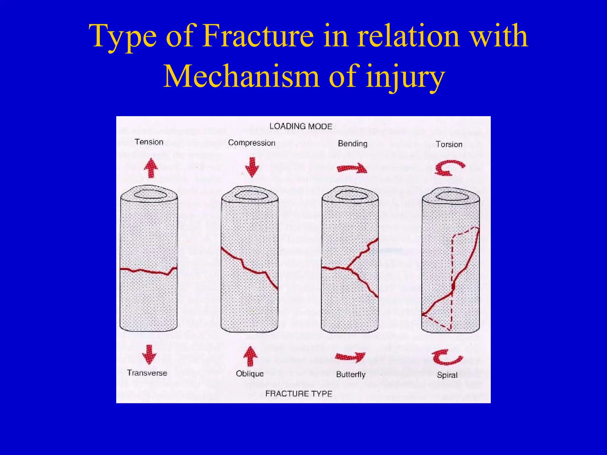 Fracture classification and General principles of management.ppt