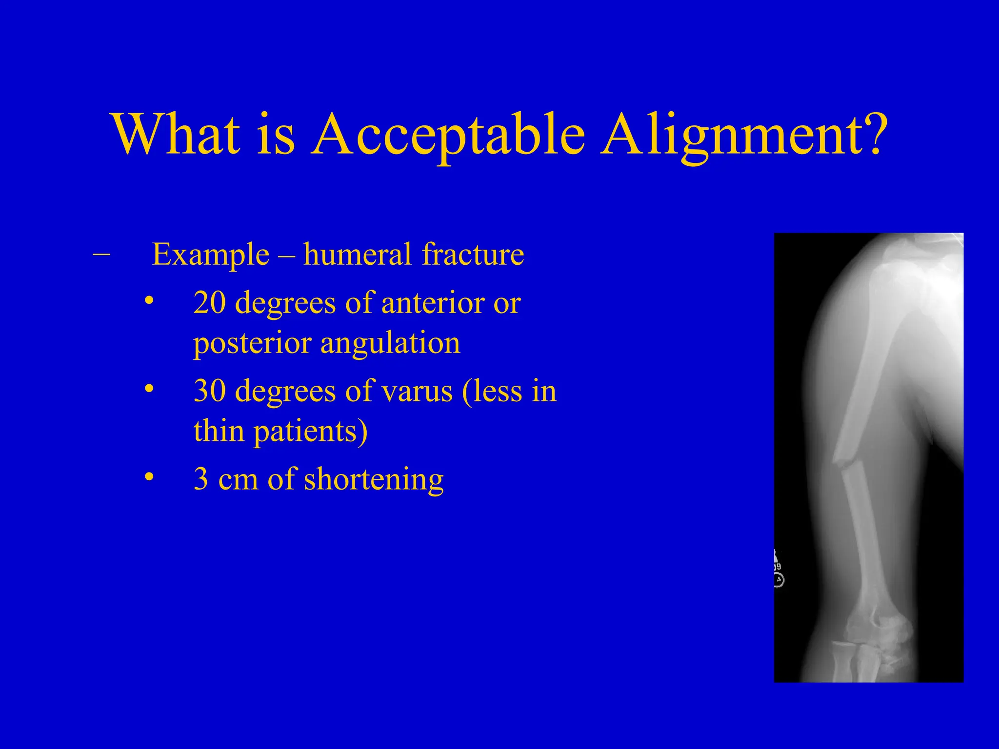 Fracture classification and General principles of management.ppt