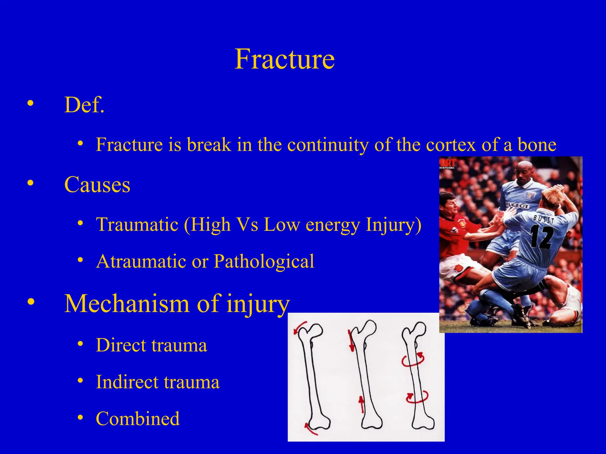 Fracture classification and General principles of management.ppt