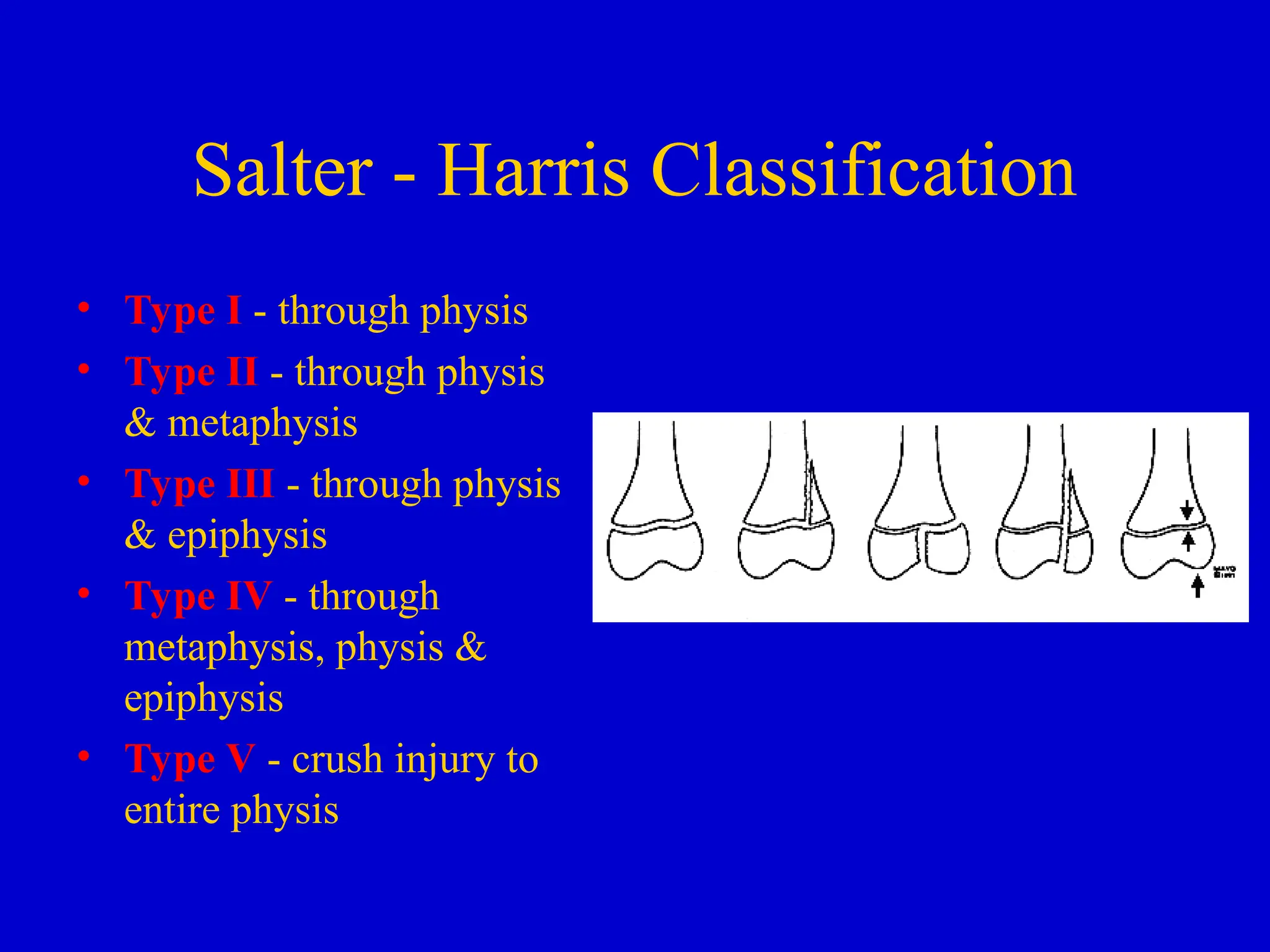 Fracture classification and General principles of management.ppt
