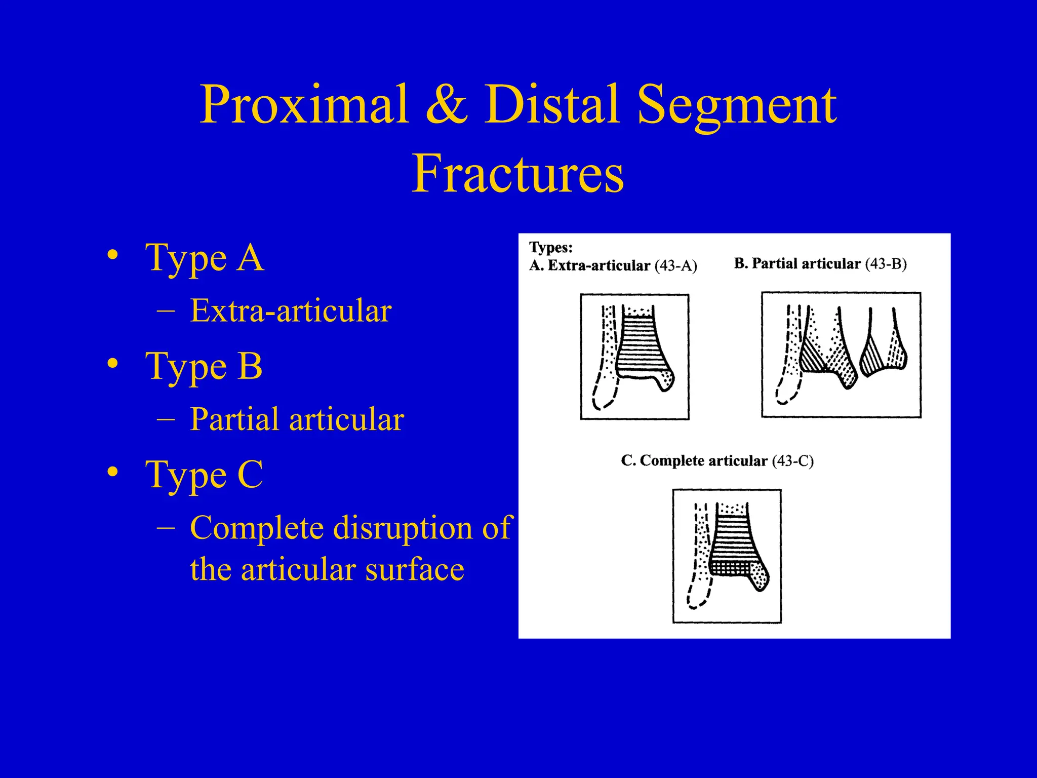 Fracture classification and General principles of management.ppt