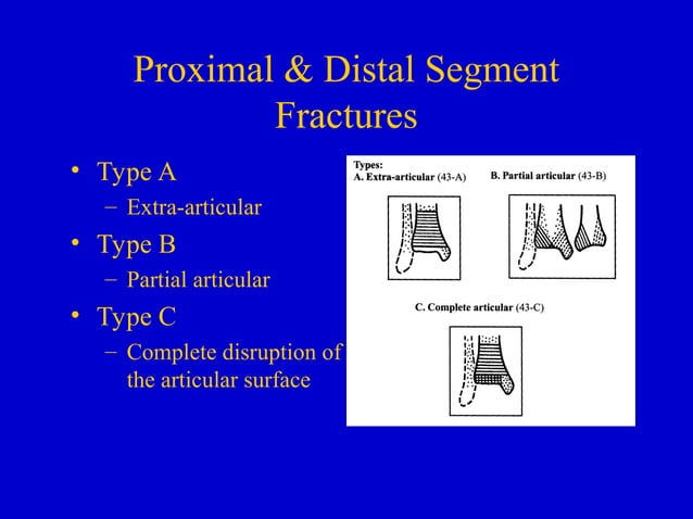 Fracture classification and General principles of management.ppt