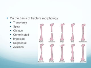 Fracture , classification and healing | PPTX