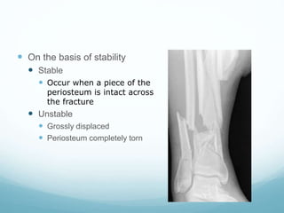 Fracture , classification and healing | PPTX