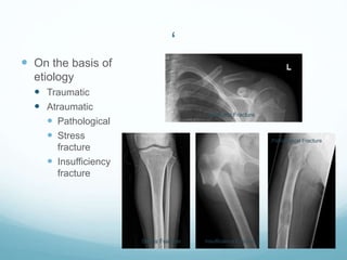 Fracture , classification and healing | PPTX