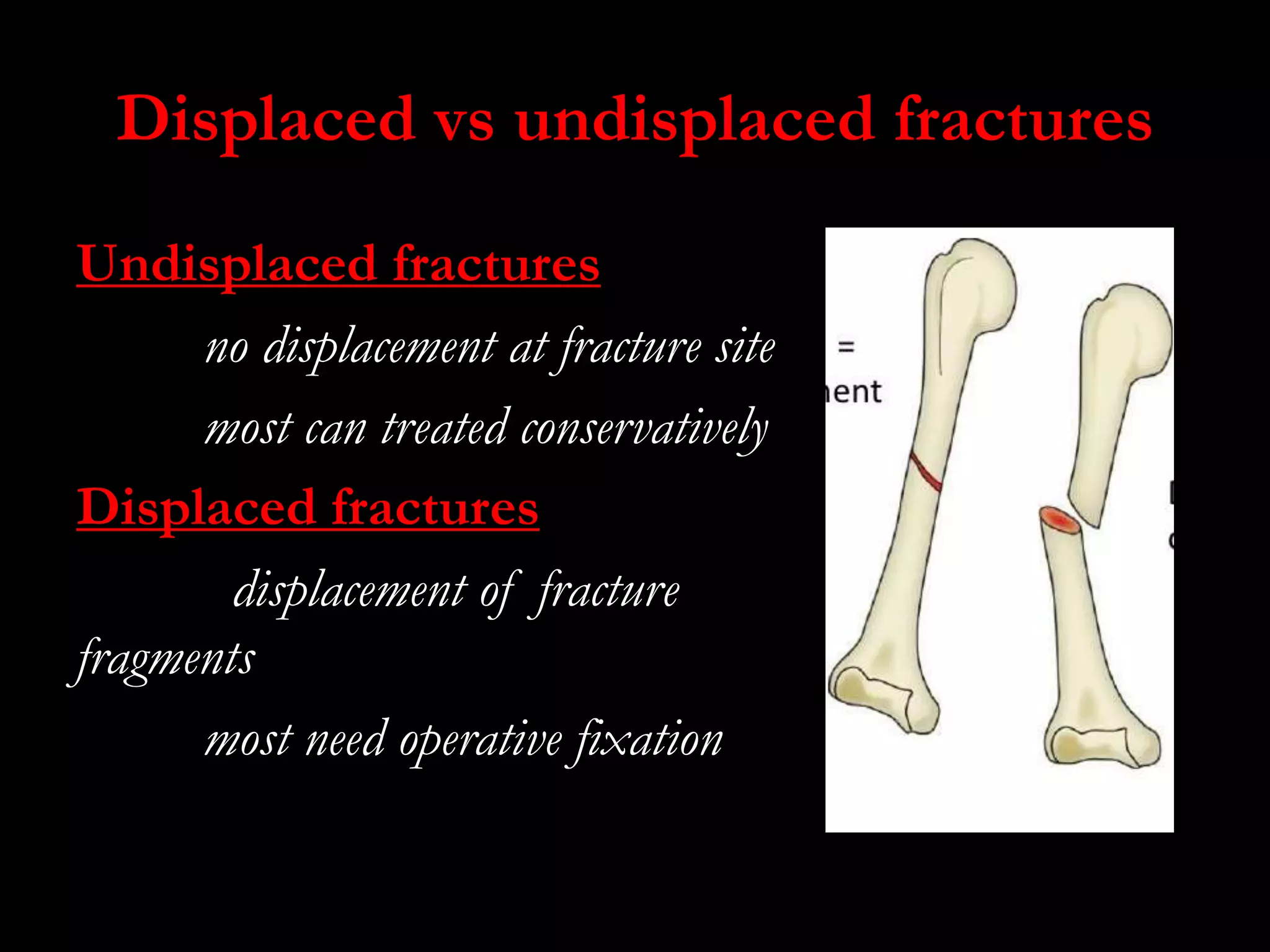 Fracture classification, healing | PPTX
